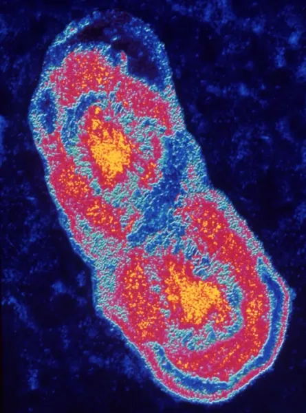 Coxiella burnetti bacterium dividing Our beautiful Wall Art and Photo ...