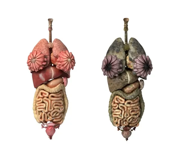 Healthy and diseased organs, artwork Our beautiful Wall Art and Photo ...