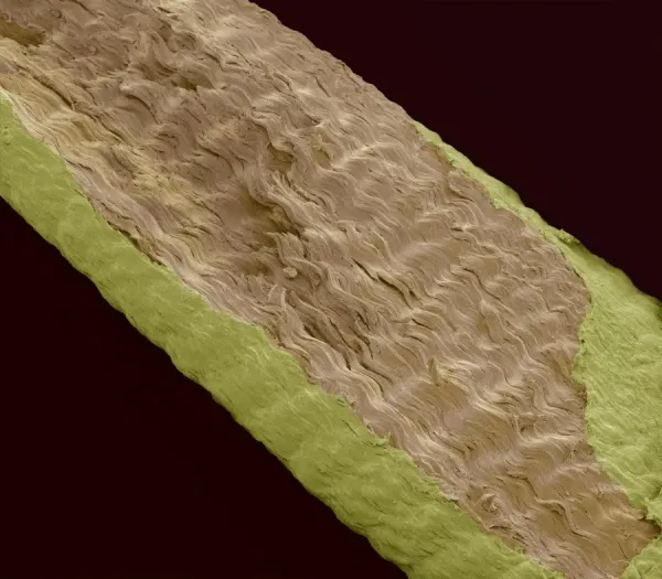 Primate hand tendon, SEM Our beautiful Wall Art and Photo Gifts include ...