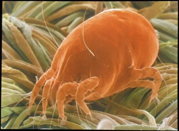 Dust Mite Electron Microscope