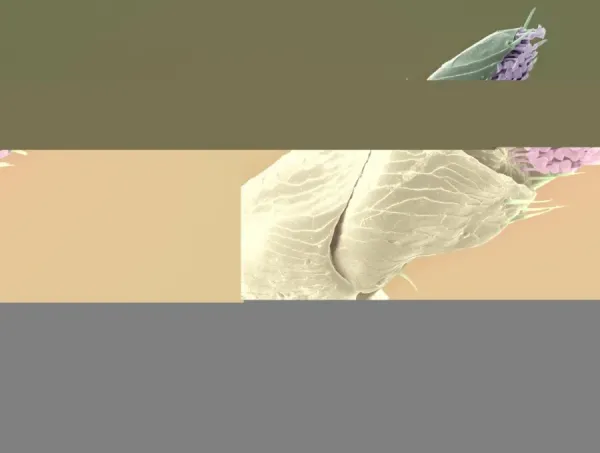 Squirrel flea antenna, SEM Our beautiful Wall Art and Photo Gifts ...