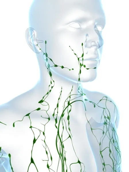 Swollen lymph nodes, artwork Our beautiful Wall Art and Photo Gifts ...