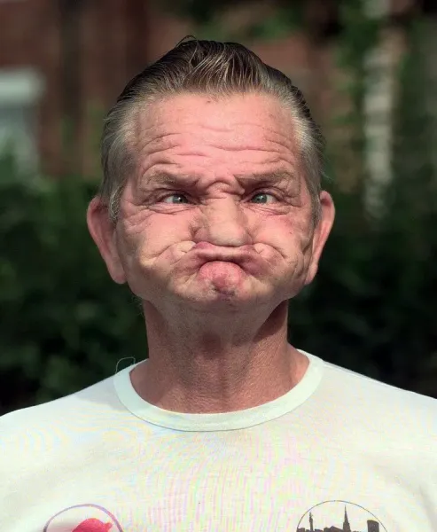 Mr Dennis Russell of Walsall, with one of his Gurning faces