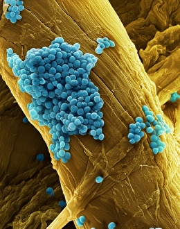 Streptococcus Pneumoniae Art Prints, Posters & Puzzles