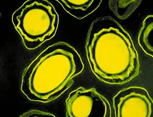 Bacillus Anthracis Art Prints, Posters & Puzzles
